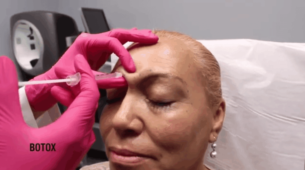 botox 11 wrinkle removal - Cosmetic Laser Dermatology Skin Specialists ...