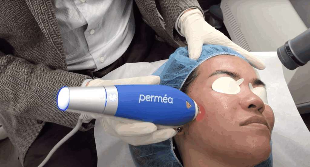 Scar & Acne Scar Treatment Med Spa | San Diego, CA | CLDerm