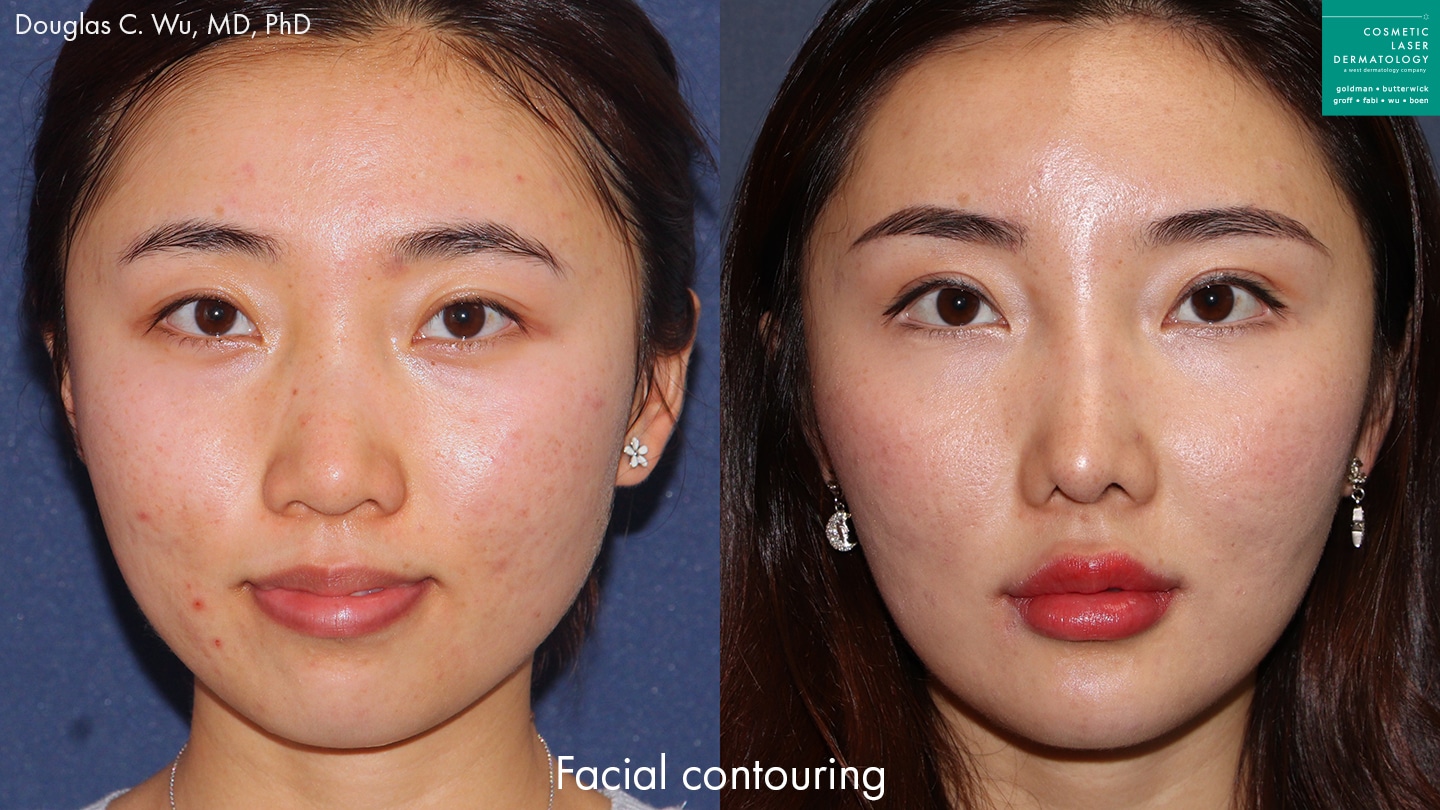 Asian Skin Dermatology Experts San Diego CA CLDerm