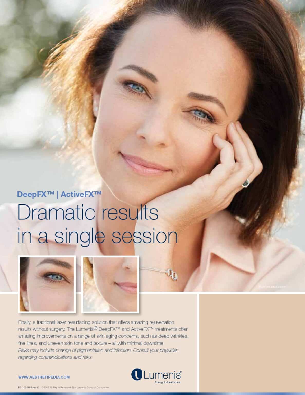 Active Deep FX Laser Resurfacing | Cosmetic Laser Dermatology