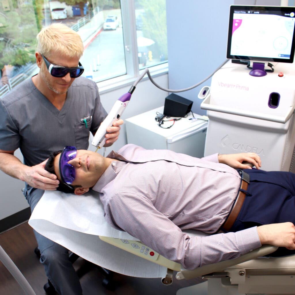 VBeam Perfecta Laser Skin Treatment | San Diego, CA | CLDerm