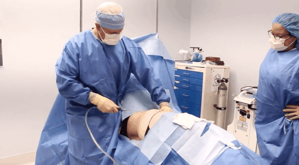 Abdomen & Flank Body Contouring | San Diego, CA | CLDerm