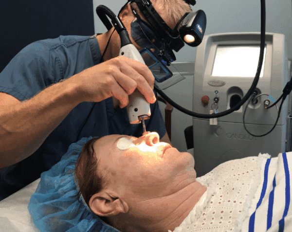 Lumenis UltraPulse System - Cosmetic Laser Dermatology Skin Specialists ...