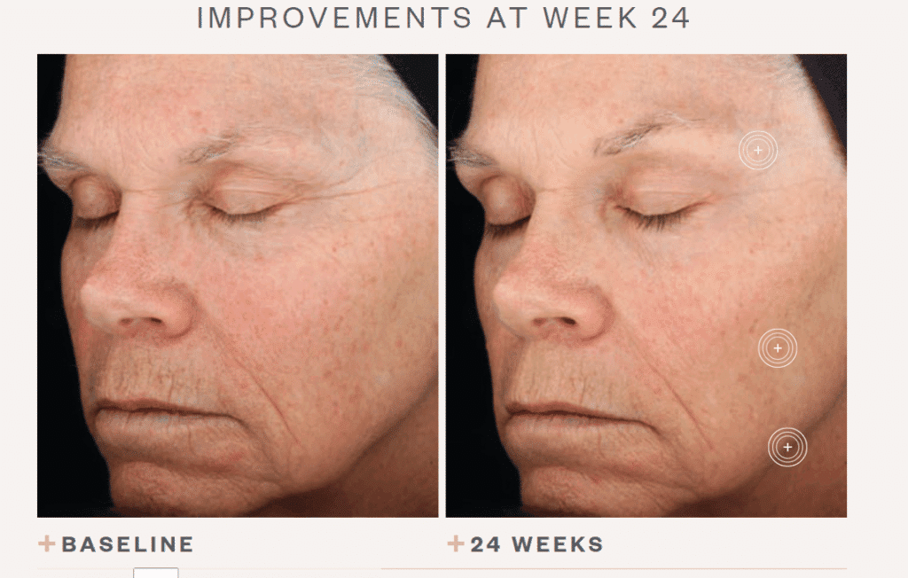 SkinMedica TNS Advanced+ Serum - Cosmetic Laser Dermatology Skin ...