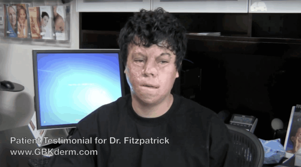 Dermatologists Help Trauma Victims with Scars in San Diego
