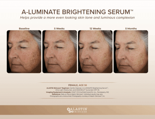 Alastin A-LUMINATE Brightening Serum - Cosmetic Laser Dermatology Skin Specialists in San Diego