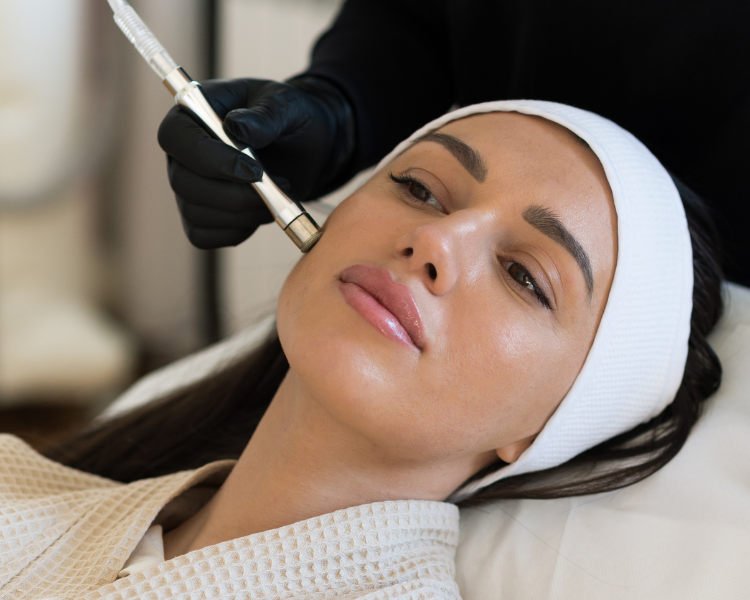 Microdermabrasion In San Diego Ca Cosmetic Laser Dermatology Skin