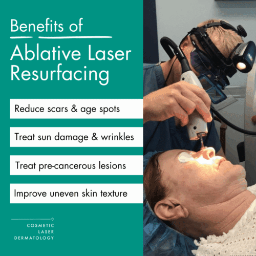 Enhancing Your Natural Beauty with Ablative Laser Resurfacing - Cosmetic Laser Dermatology Skin ...