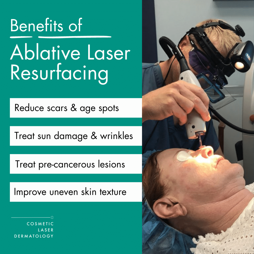 Enhancing Your Natural Beauty with Ablative Laser Resurfacing - Cosmetic Laser Dermatology Skin ...