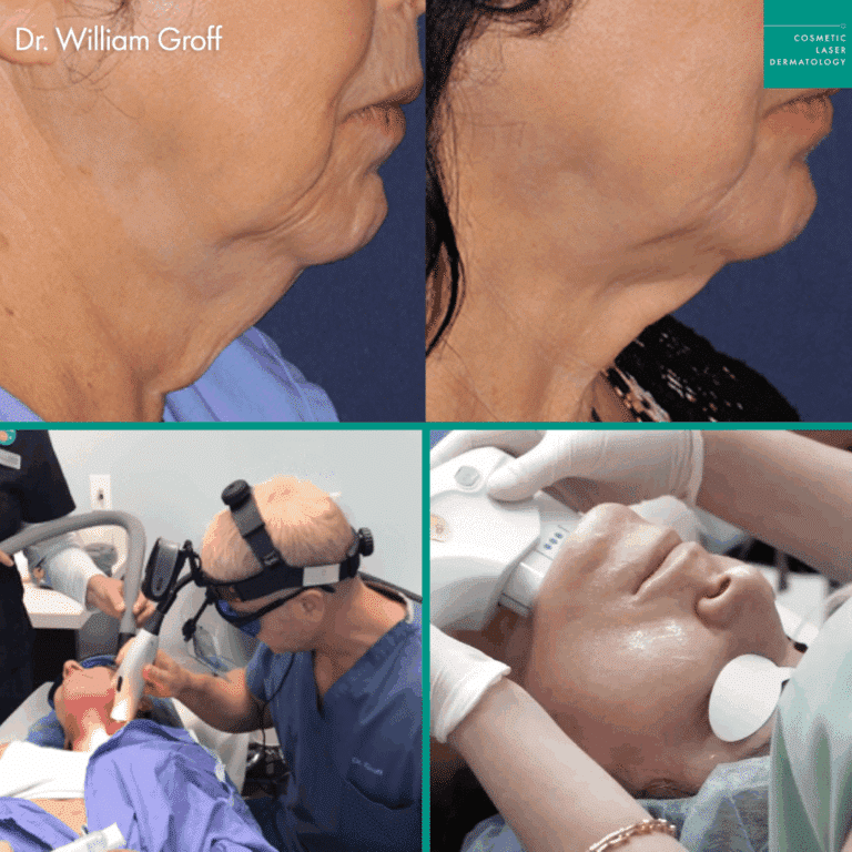 Bothered by Neck Lines? Dermatologists Talk About the Causes and ...